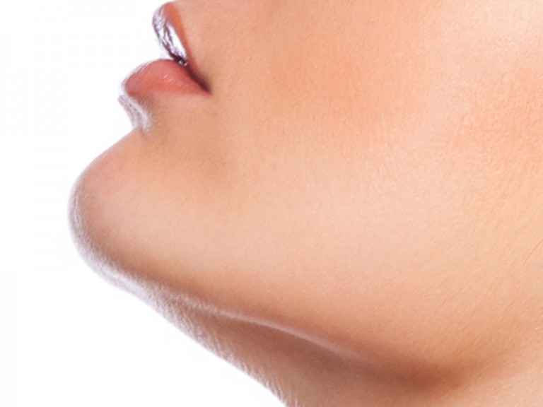 Chin and Cheek Implants | The Center for Facial Plastic Surgery
